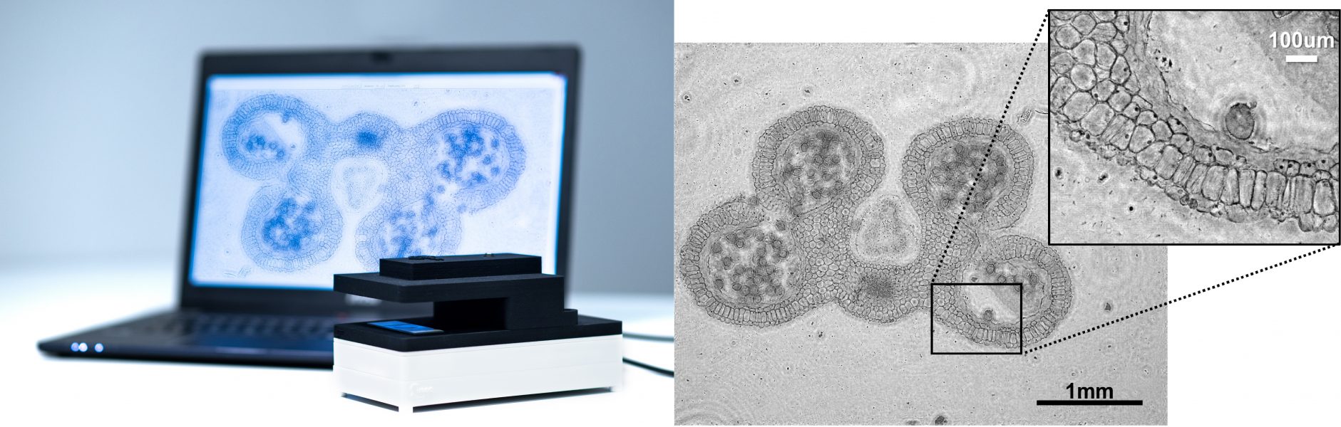 Imec Presents Compact Lens-Free Digital Microscope | New-TechEurope