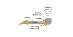 Implantable “Neural Dust” Enables Precise Wireless Recording of Nerve ...